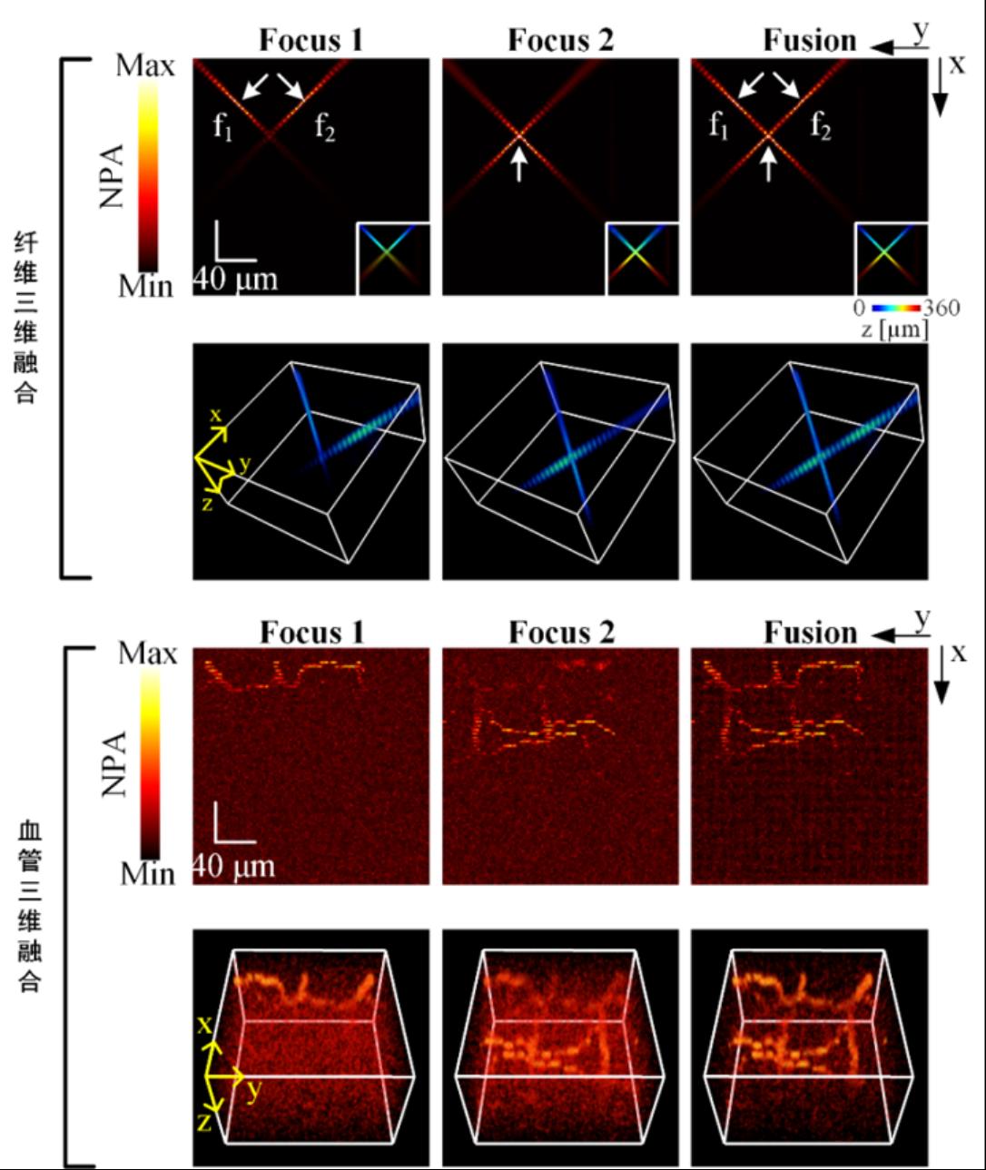 我校青年教师宋贤林在光声成像方面取得系列重要进展 - 南昌大学新闻网欢迎您！